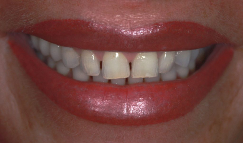 TEL: 020 7099 1108 | (Free) 0800 047 0842