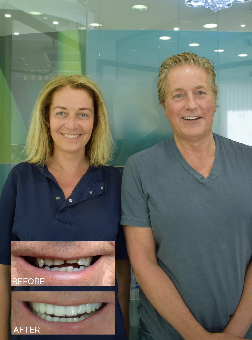 Smile Studio: Full Mouth Makeovers & Implant Results